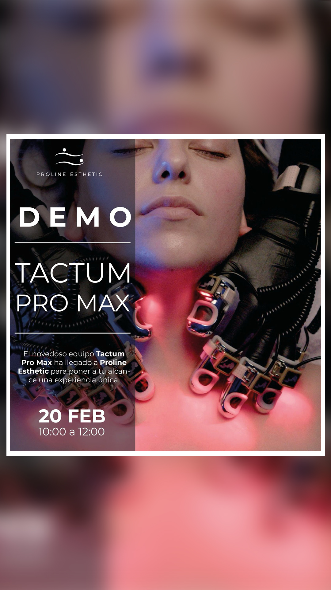 FORMACIÓN – Proline Esthetic